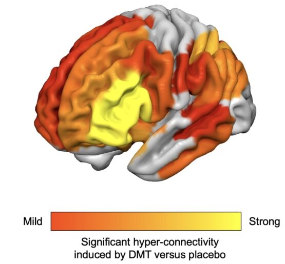 Scientists Reveal How DMT Affects the Brain's Advanced Functions ...